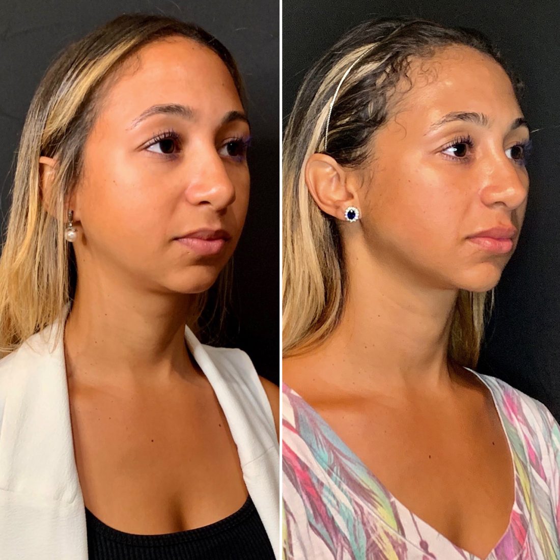 RESULTS - Jordan Jacobs — Medical Artistry