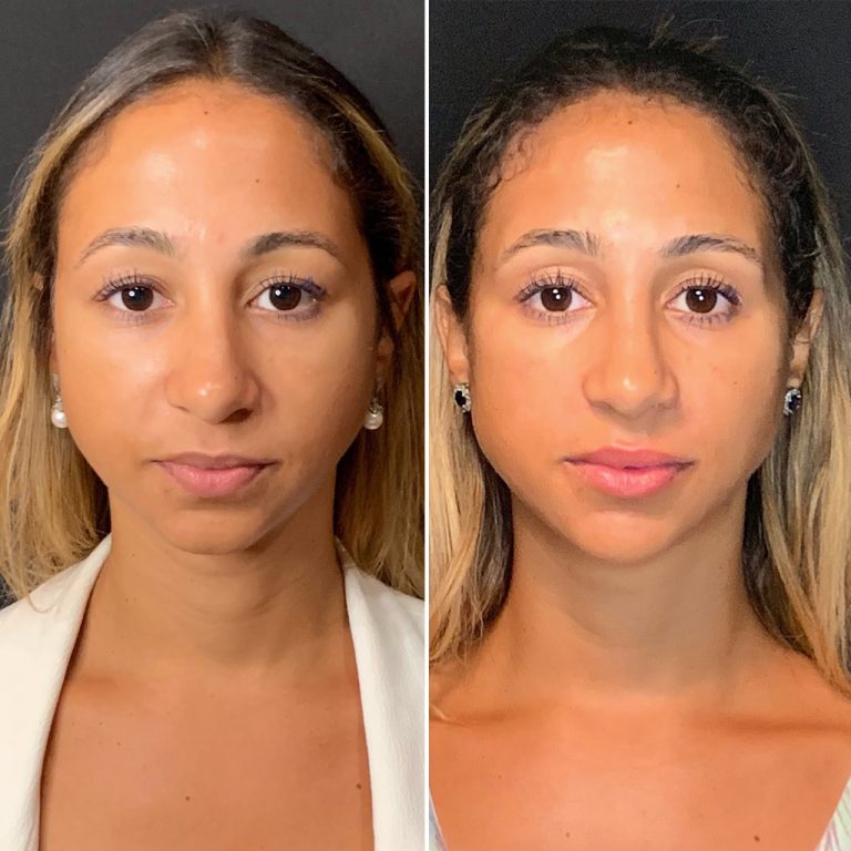 RESULTS - Jordan Jacobs — Medical Artistry